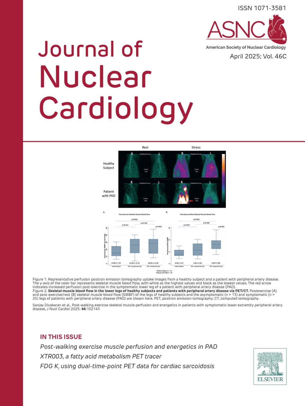 F-18 PET Tracer Shows Potential for Assessing Fatty Acid Metabolism - ASNC