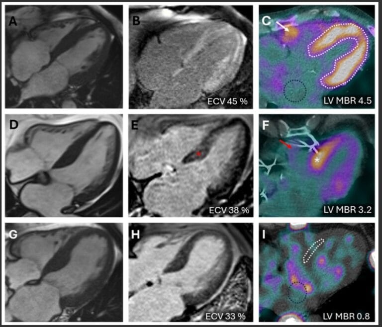 ASNC - American Society of Nuclear Cardiology
