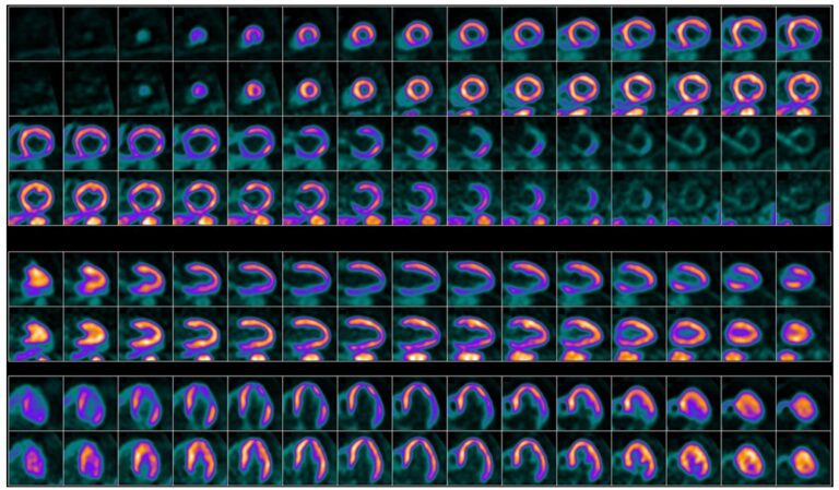 New International Guideline Provides Expert Guidance for F-18 ...